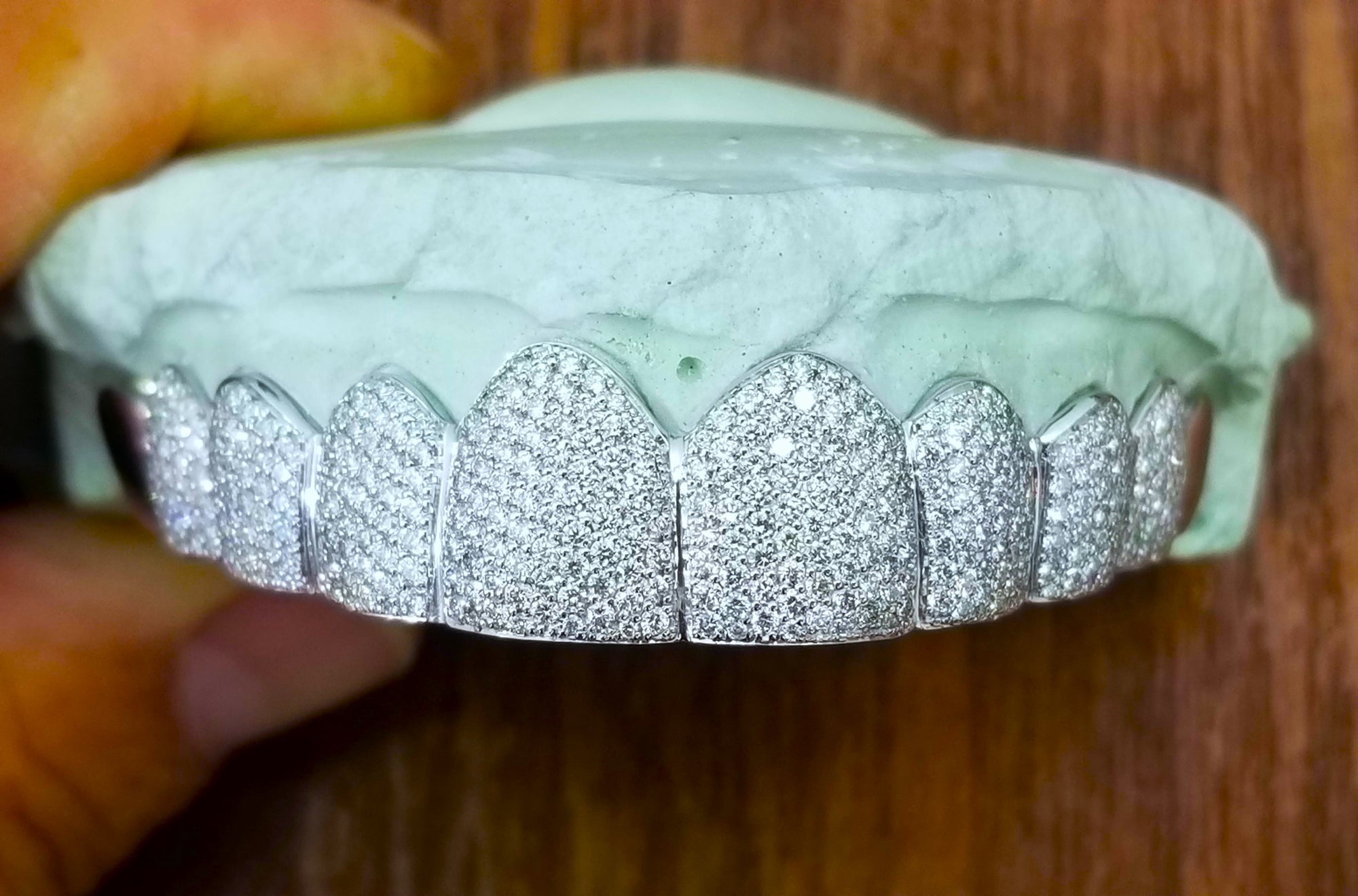 GoldTeethAmerica | Dallas' #1 Choice for Affordable Custom Gold Grillz ...