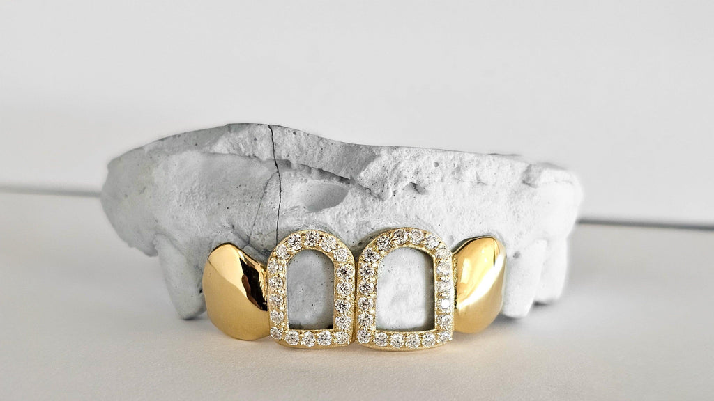 Golden Frame Grillz - Yellow Gold Shine – Gold Teeth America