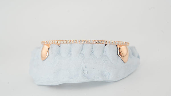 Custom Gold Rail Set Top Bar with Diamonds | Gold Teeth America