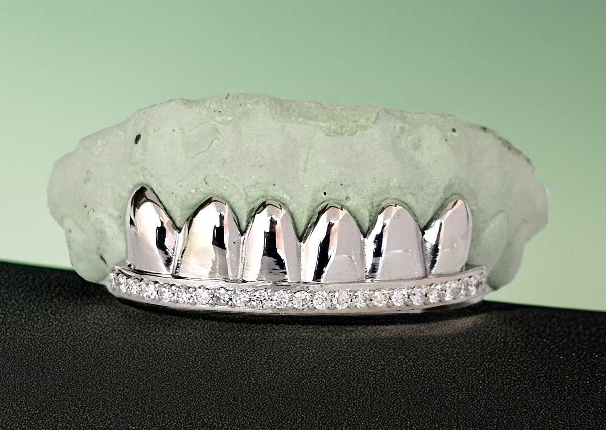 GoldTeethAmerica | Dallas' #1 Choice for Affordable Custom Gold Grillz ...
